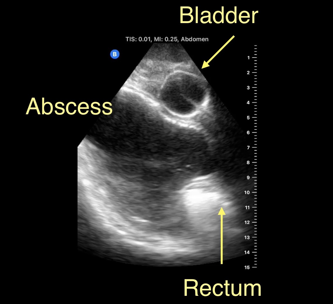 The Hauns in Africa - William, Heidi, Trey & KJ´s adventures in Ghana